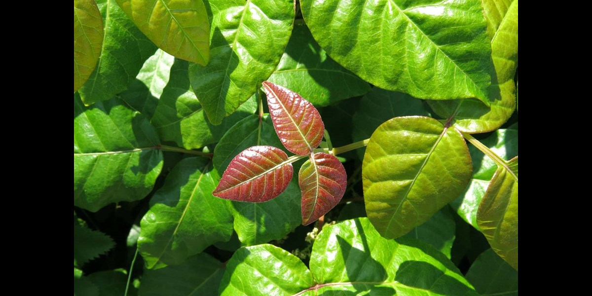 Poison Ivy Burn